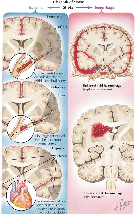 Vasculature Clinical Tree