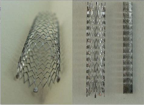 Stents