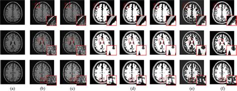 The Optimization And Merging Process Of Brain Mr Superpixel Test Download Scientific Diagram