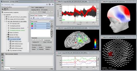 Brainstorm A Matlab Based Open Source Application For Advanced Megeeg Data Processing And