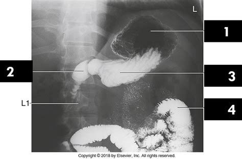 Ugi 3 Essential Terminology And Anatomy Of The Upper Gastrointestinal