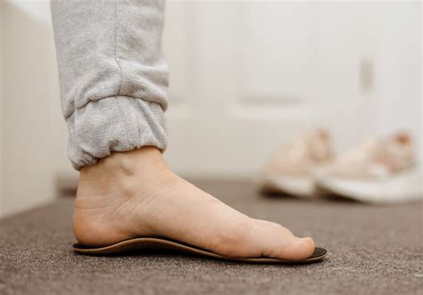 Why Do Arch Supports Hurt My Flat Feet