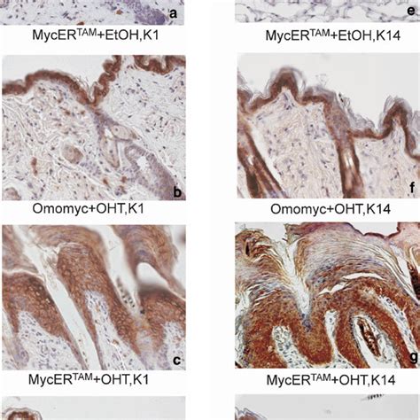 Omomyc Potentiates Myc Induced Apoptosis Both In Vitro And In Vivo A