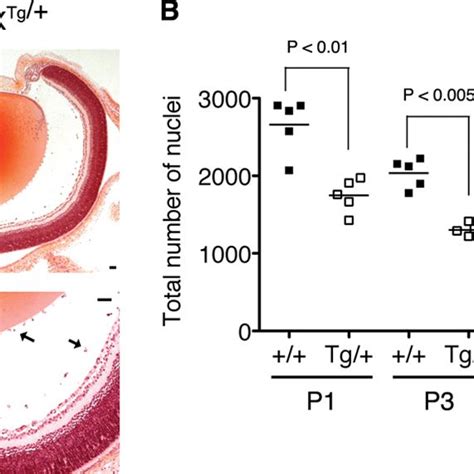 Regression Of Hyaloid Vessels Is Accelerated In Atx Tg Mice A At