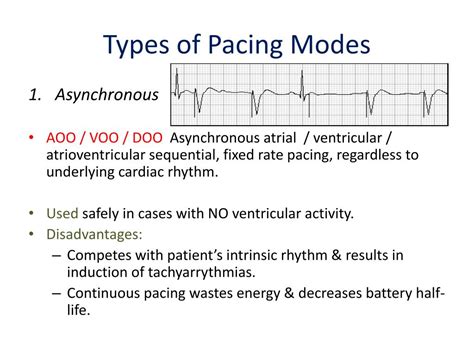 Ppt Anesthetic Considerations In Patients With Cardiac Pacemaker