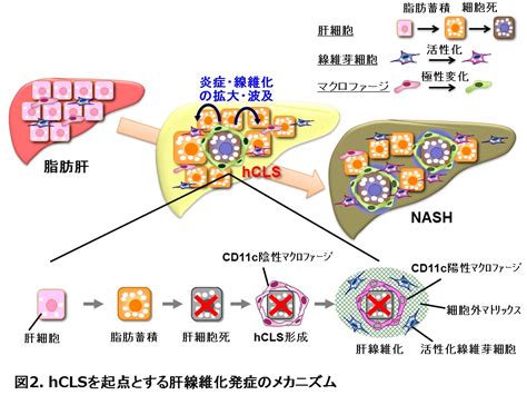 非アルコール性脂肪肝炎（nash）の新たな病態メカニズムの解明 短期間でnashを発症する疾患モデルの開発を通して 研究成果