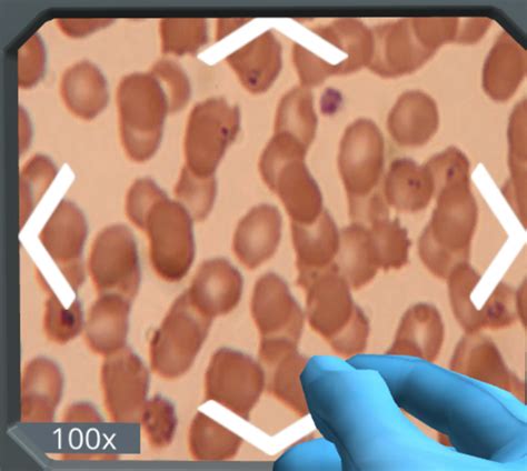 Solved Control Sample Test Result Ref Range Wbc 6 2 4 11
