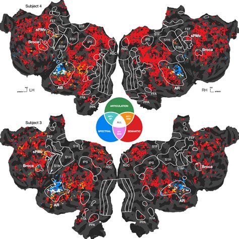 Figure 1 From The Hierarchical Cortical Organization Of Human Speech