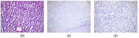 Langerhans Cells—revising Their Role In Skin Pathologies Pmc