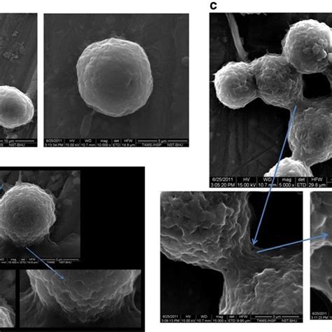 Morphological Analysis Of Peritoneal Normal Resident Macrophages