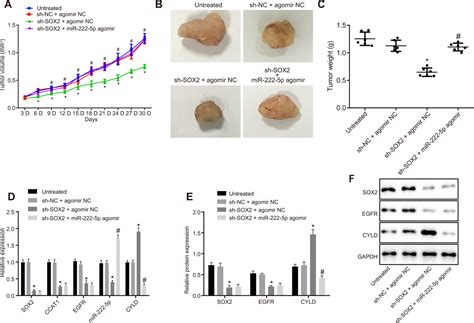 Anti Oncogenic Effects Of Sox2 Silencing On Hepatocellular Carcinoma