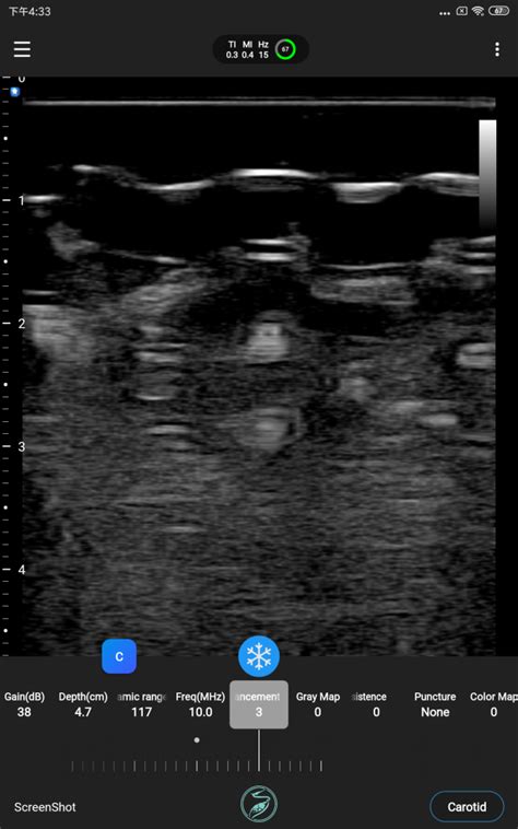 Convex Probe Stork Healthcare Convex Ultrasound… By Stork Medium