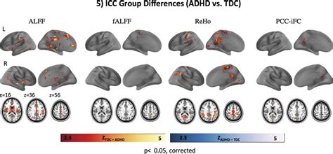 Icc Group Differences Adhd Vs Tdc Results Of Voxel Wise Comparison