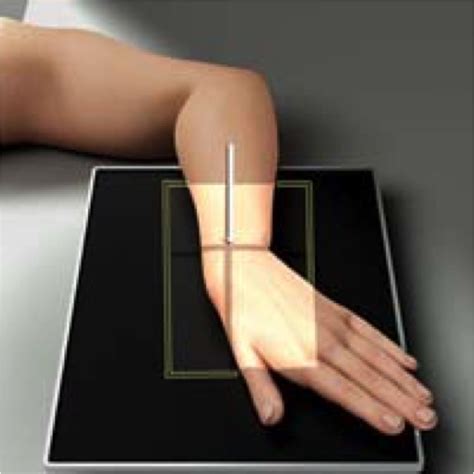 Wrist Trauma Radiographic Evaluation Hand Orthobullets