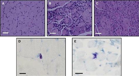 Transverse Quadriceps Muscle Sections Stained With Haematoxylin And