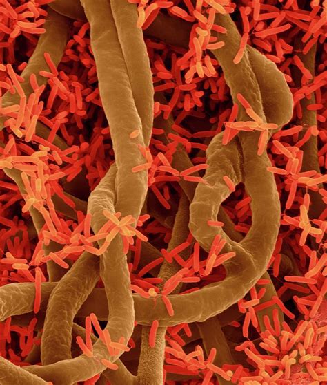 Pseudomonas And Pythium Photograph By Dennis Kunkel Microscopyscience