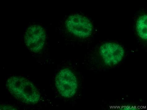 Nrf1nuclear Respiratory Factor 1 Antibody 66832 1 Ig Proteintech
