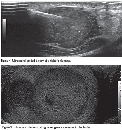 Multiple Cutaneous Nodules In A Previously Healthy Male Consultant