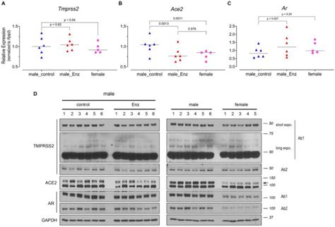 Sex Androgens And Regulation Of Pulmonary Ar Tmprss2 And Ace2 Pmc