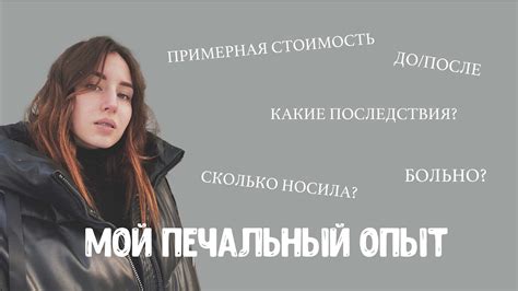 Брекеты Мой опыт Все ни как у всех Youtube
