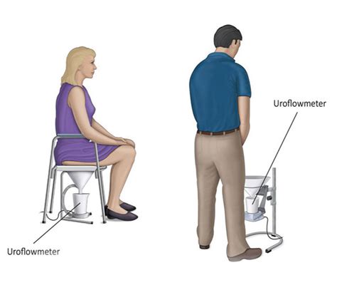 Uroflowmetry A Quick Test To Measure Urine Flow