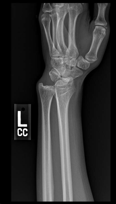 Was Told That This Was No More Than Soft Tissue Swelling Can Someone Confirm Or Explain R