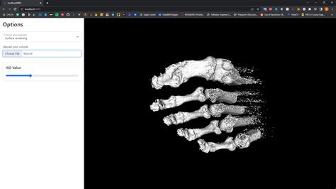Github Alykhaledvtk Ray Casting And Surface Rendering