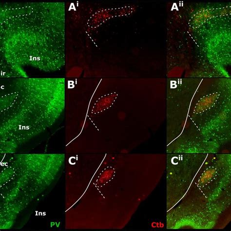 Tracer Injections Of The Non Toxin Subunit B Of Cholera Toxin Ctb
