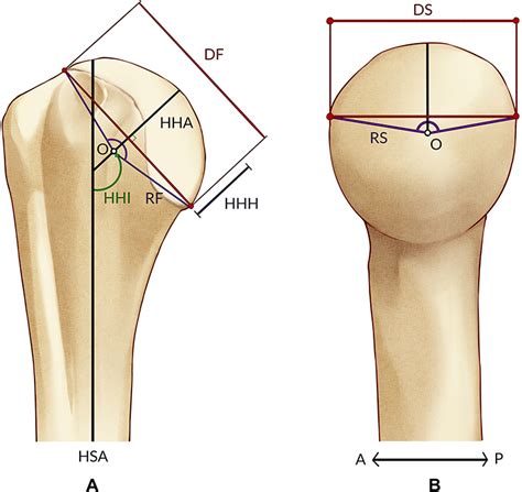 Morphology Of Humeral Head And Glenoid In Normal Shoulders Orr
