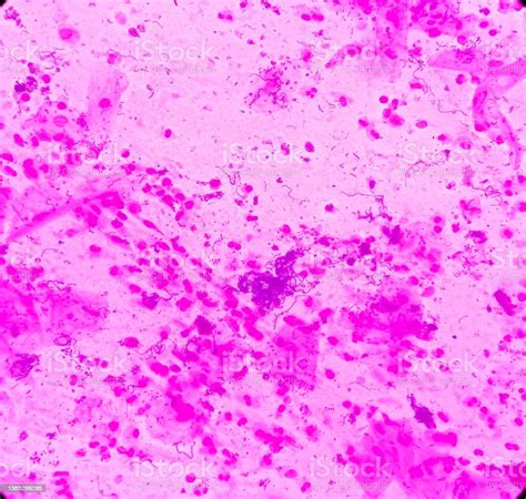 Sputum Gram Stain Microscopic View Show Plenty Pus Cells And Few