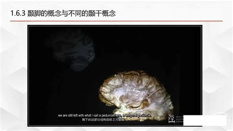 【解剖知识】边缘系统 脑医汇