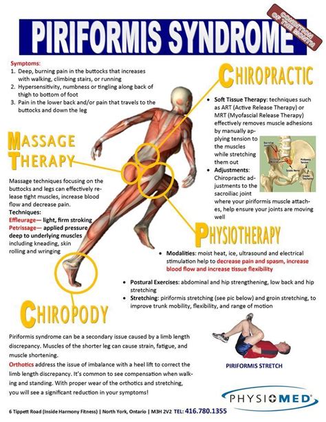 Piriformis Syndrome Symptoms Diagnosis And Treatment
