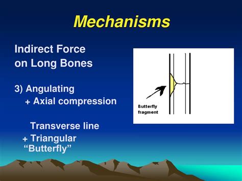 Ppt Principles Of Fractures Powerpoint Presentation Free Download Id5412029