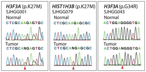 Recurrent Somatic Mutations In H3f3a And Hist1h3b Sanger Sequencing Download Scientific Diagram