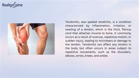 Ppt Tendonitis Symptoms And Causes Powerpoint Presentation Free Download Id 12908825