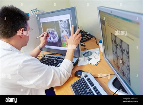 Imrt Intensity Modulated Radiation Therapy Abdomen Cancer 3d