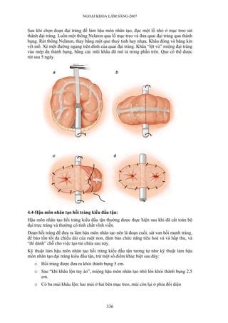 Hậu môn nhân tạo PDF