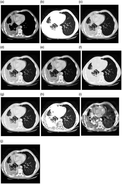 Image Fusion Based On Shift Invariant Shearlet Transform And Stacked
