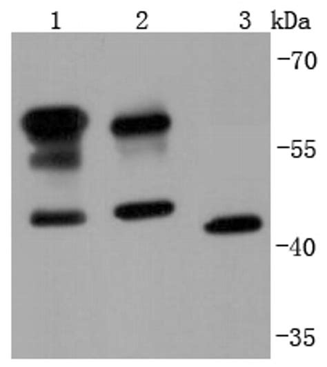 Cd147 Recombinant Monoclonal Antibody Jf1 045 Ma5 32534