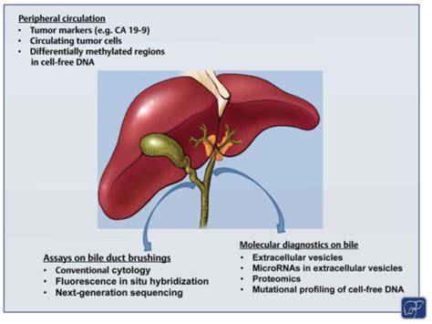 Cancers Free Full Text Current Perspectives On The Surgical Management Of Perihilar Cancers Free Full Text Current Perspectives On The Surgical Management Of Perihilar