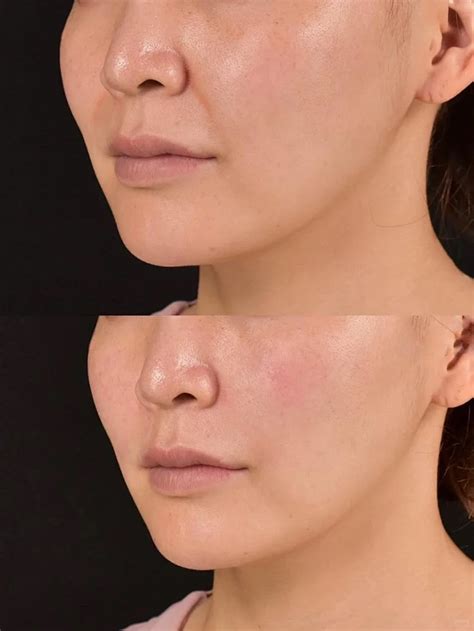 法令纹分享来噜～