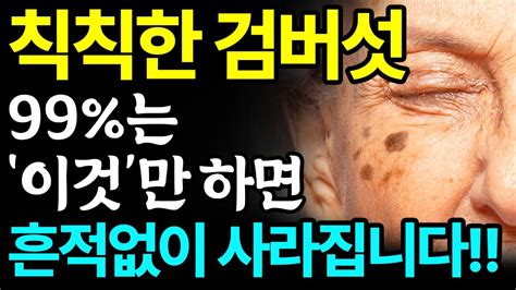집에서 검버섯 없애는 방법 3가지 총정리 피부과에 헛돈 쓰지마세요 따라만 하면 검버섯 기미 번지지 않고 싹 다 사라집니다 Youtube