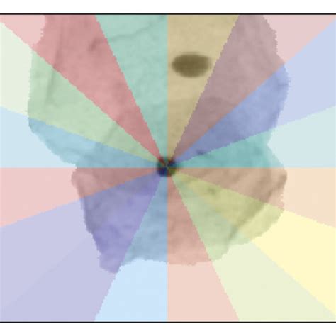 the flowchart of the cervical cell segmentation method download