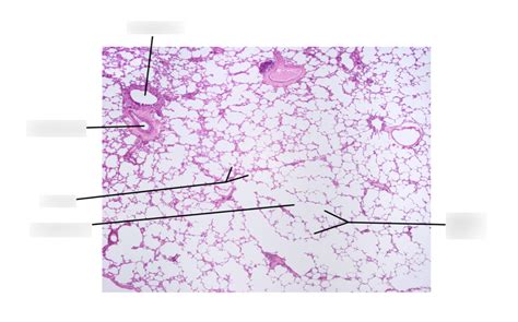 Histology Of The Lungs Flashcards Quizlet The Best Porn Website