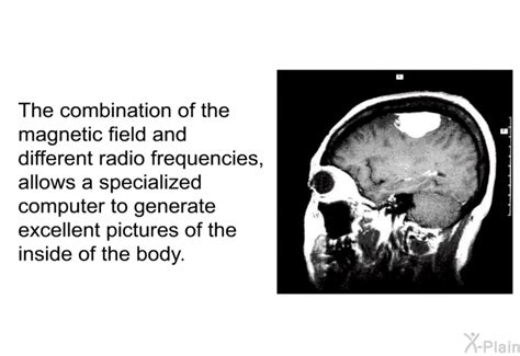 Magnetic Resonance Imaging Scan Mri