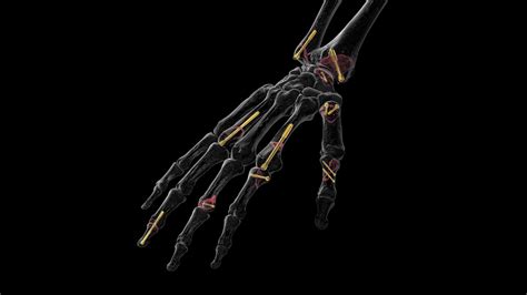 Ccs Upper Extremities