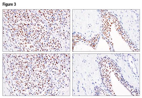 Hallmarks Of Validation Multiple Antibody Strategy Cst Blog