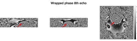 Choosing A Right Phase Unwrapping Method For Your Data SEPIA 1 2 0