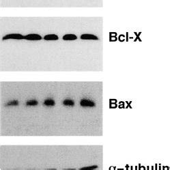 Overexpressing Constitutively Active Akt Suppresses Apoptosis After
