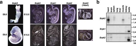 Muscle Specific Expression Of Srpk3 A Expression Of The Srpk Download Scientific Diagram